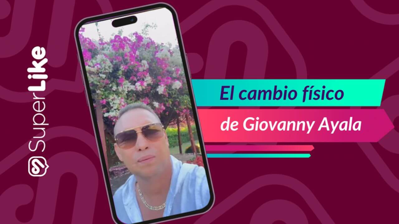 Giovanny Ayala se hizo retoque en su rostro: así quedó